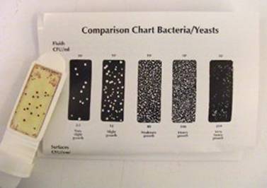 Dipslides | Water Bacteria |Bacteria Testing |Water Analysis